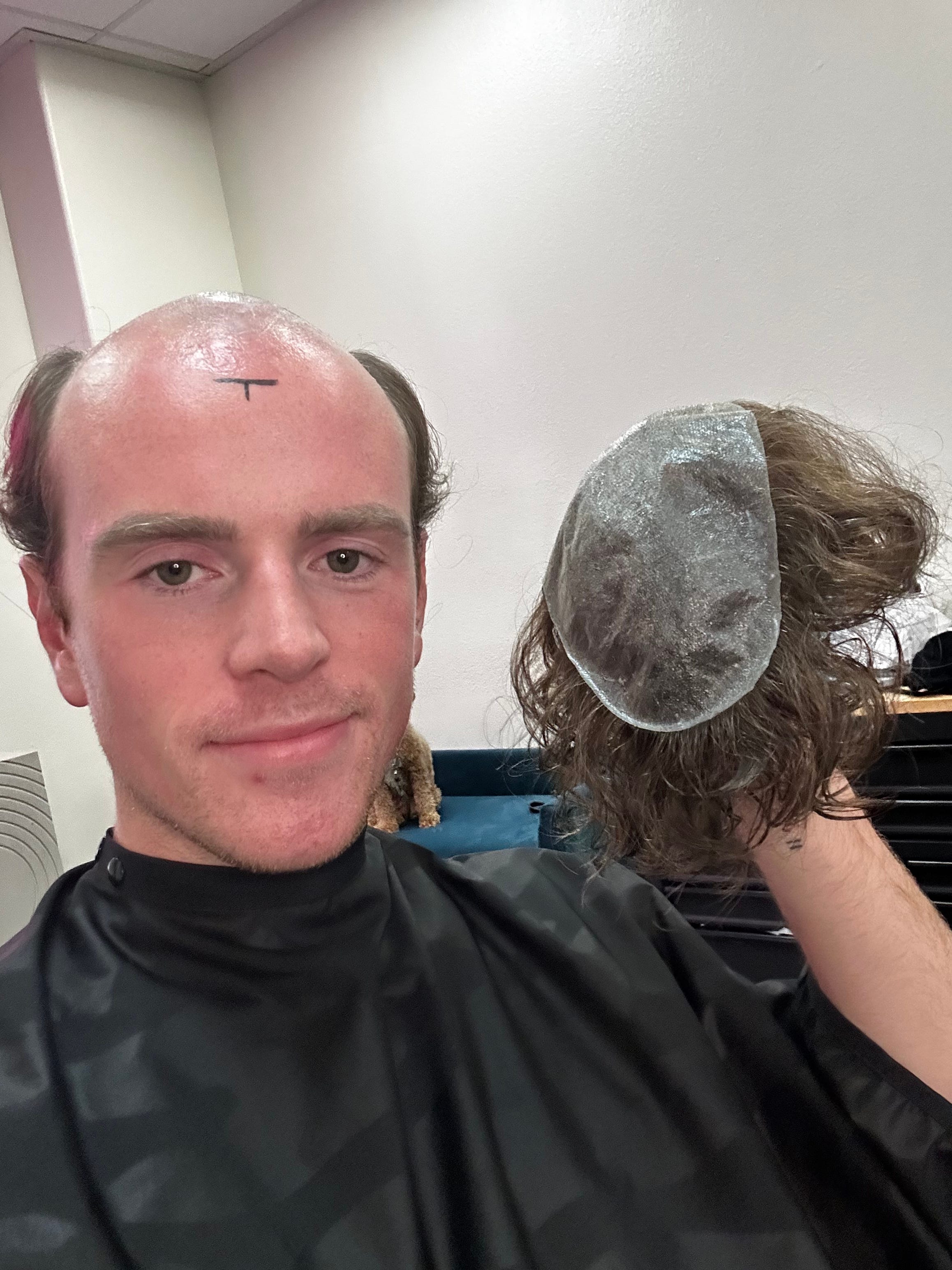 He started going bald at 18. His shocking wig video went viral — and is ...