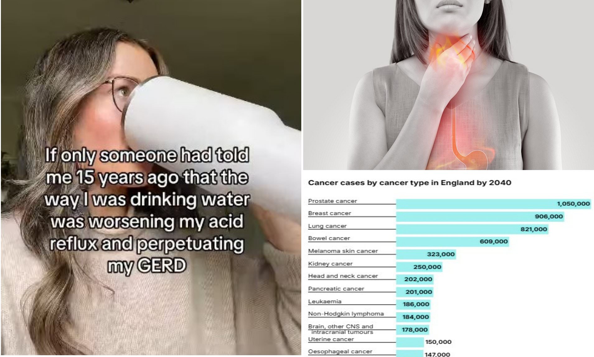 Dietician warns how you drink water can make acid reflux symptoms WORSE