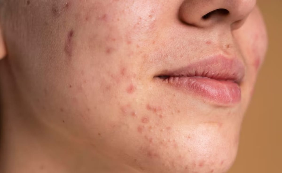 Dermatologist Reveals Common Skin Problems That Are Often Misdiagnosed