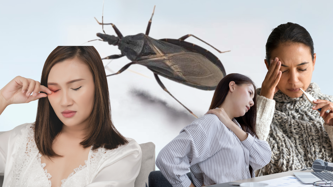 ‘Kissing Bug’ Epidemic In US: What You Need To Know About Chagas ...
