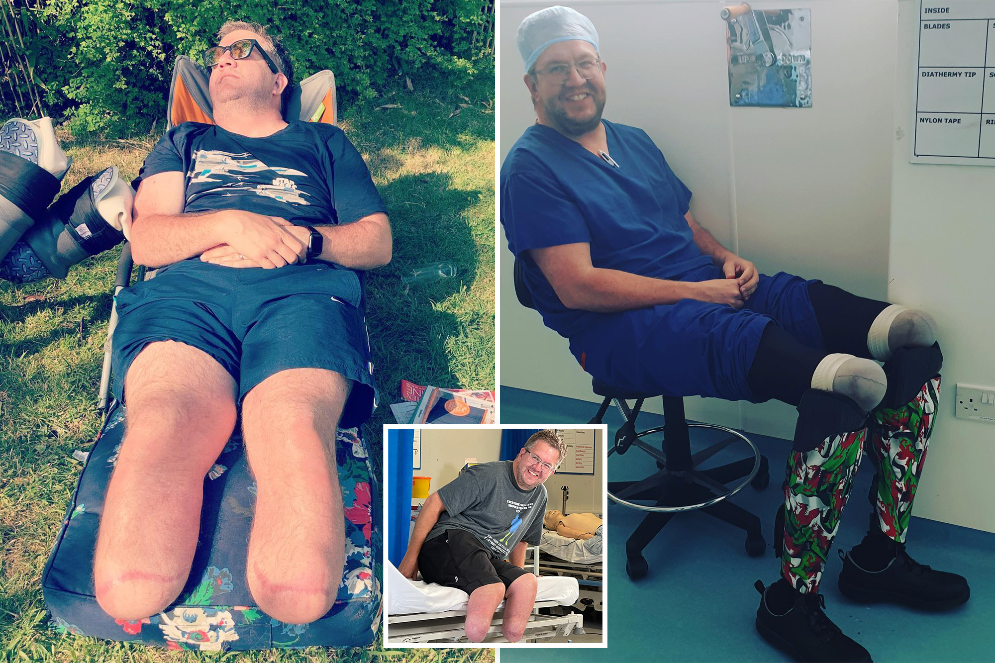 Surgeon obsessed with amputation porn has legs chopped off for $600K ...