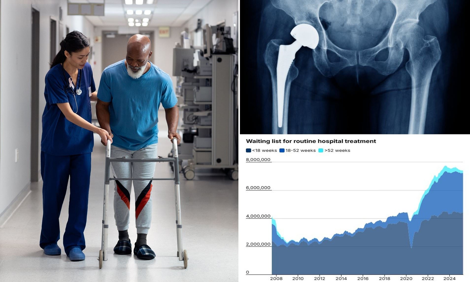 Health chiefs issue warning about NHS hip replacements: '1 in 100 ...