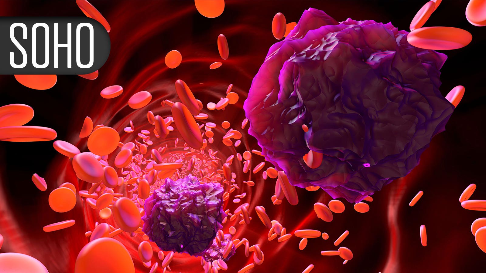 GLP-1 Agonists Show Possible Benefits for Rare Blood Cancer
