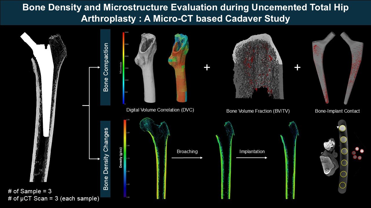 Innovative imaging techniques show what happens inside bones during hip ...