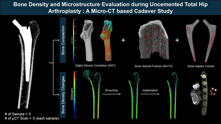 Innovative imaging techniques show what happens inside bones during hip ...