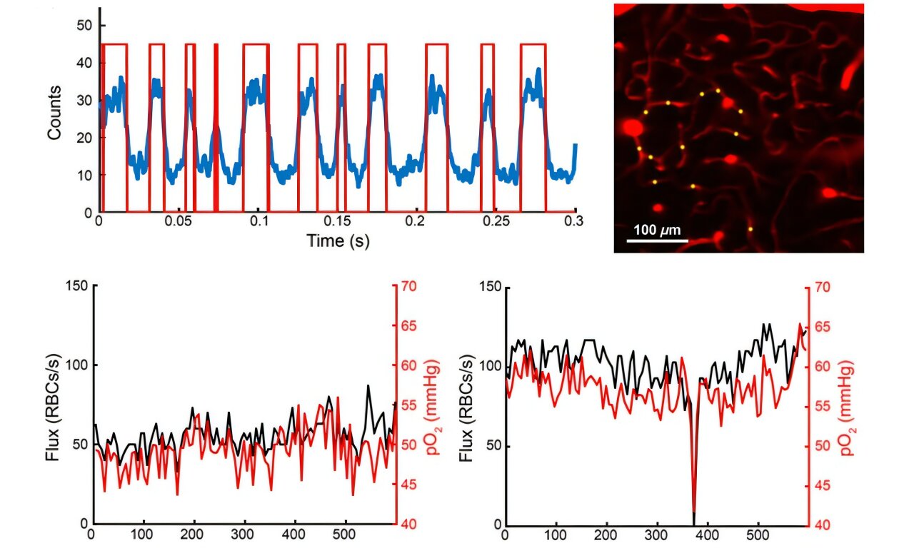 High-resolution imaging uncovers hidden risks of brain capillary stalls