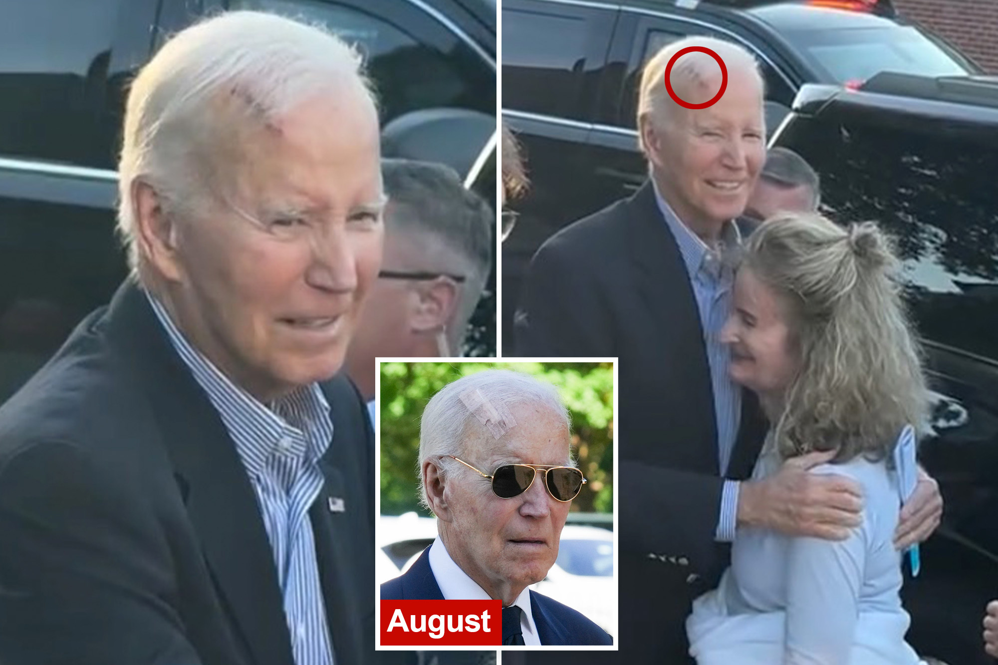 Joe Biden, 82, seen with massive head wound as former president’s ...
