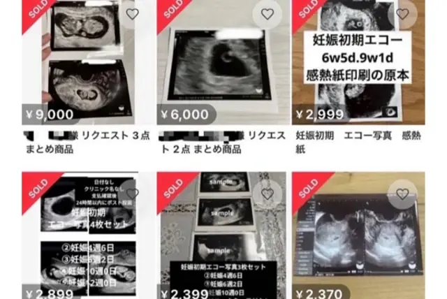 Escándalo por empresa japonesa que vendía ecografías robadas y eran ...