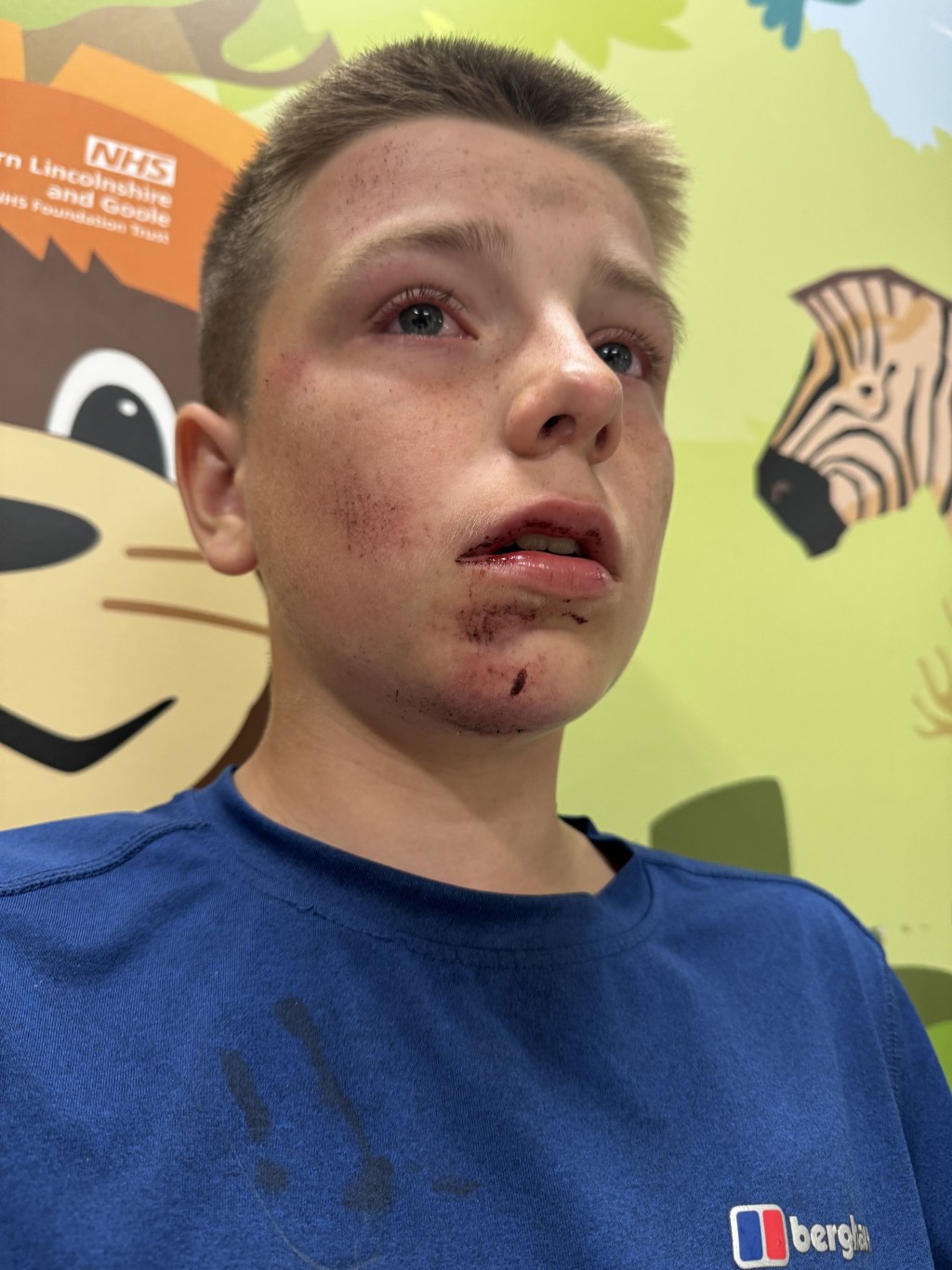 Horsing around teen nearly bites off tongue during dangerous social ...