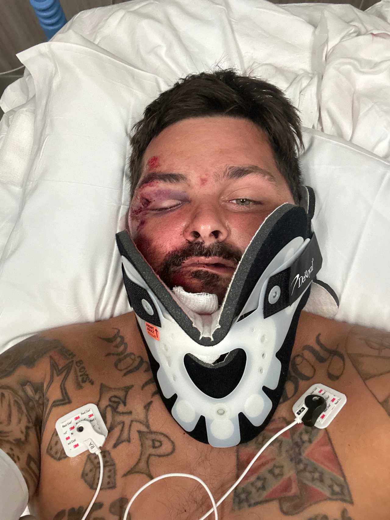 Christopher Sullivan Critically Injured In Virginia Fall