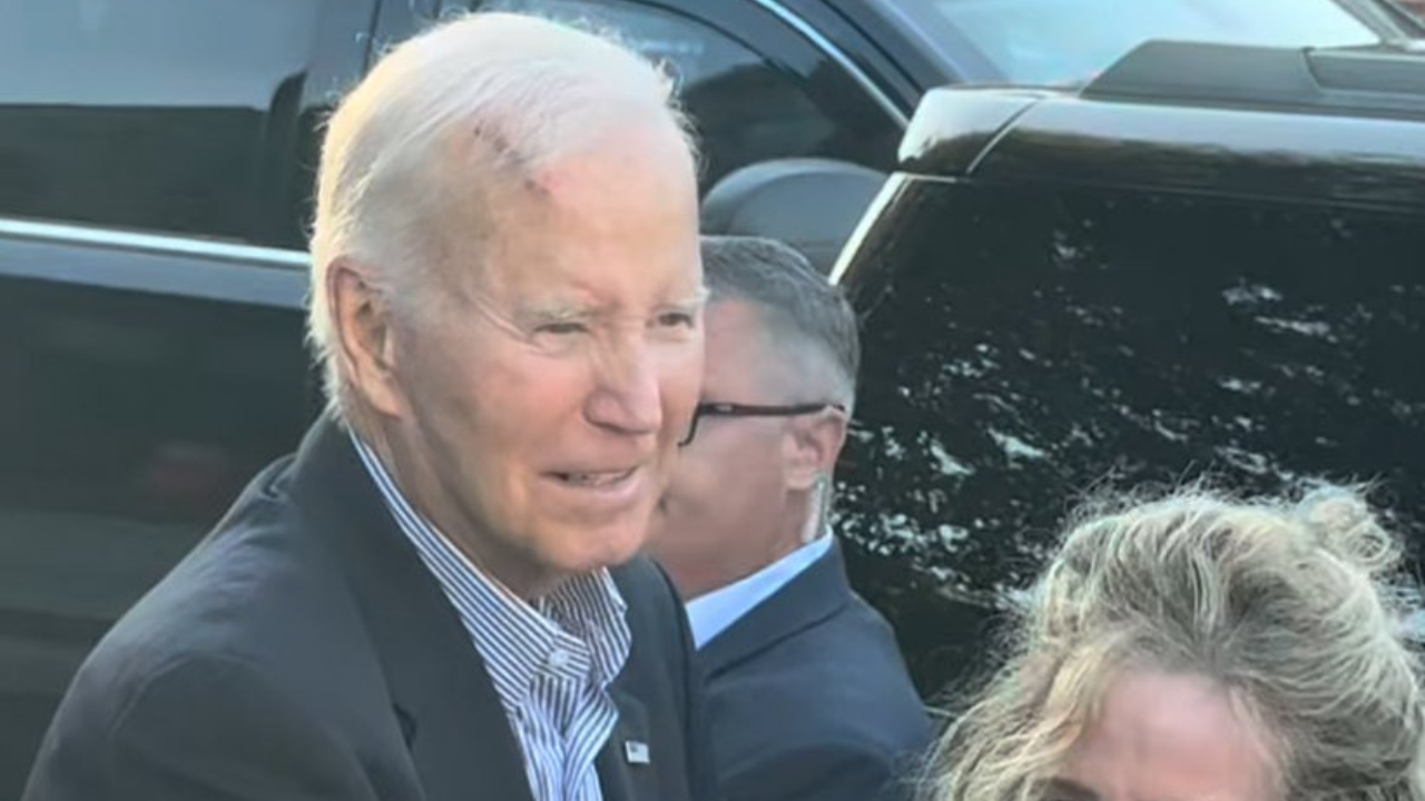 Biden Health Update: Ex-Prez Undergoes Mohs Surgery For Skin Cancer ...
