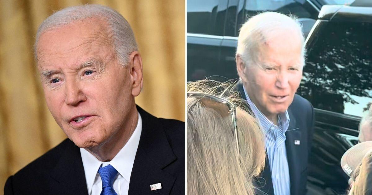Joe Biden, 82, Seen With Gash on His Forehead After Undergoing Surgery ...