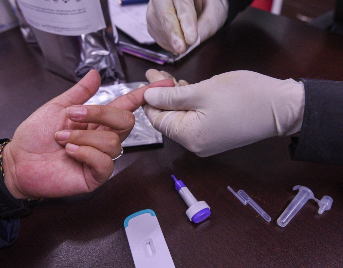 Censida: 80 mil personas en México podrían tener VIH y no lo saben