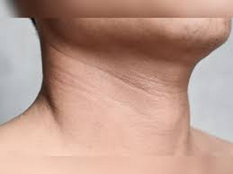 From heart to diabetes... what does the size of your neck tell about ...