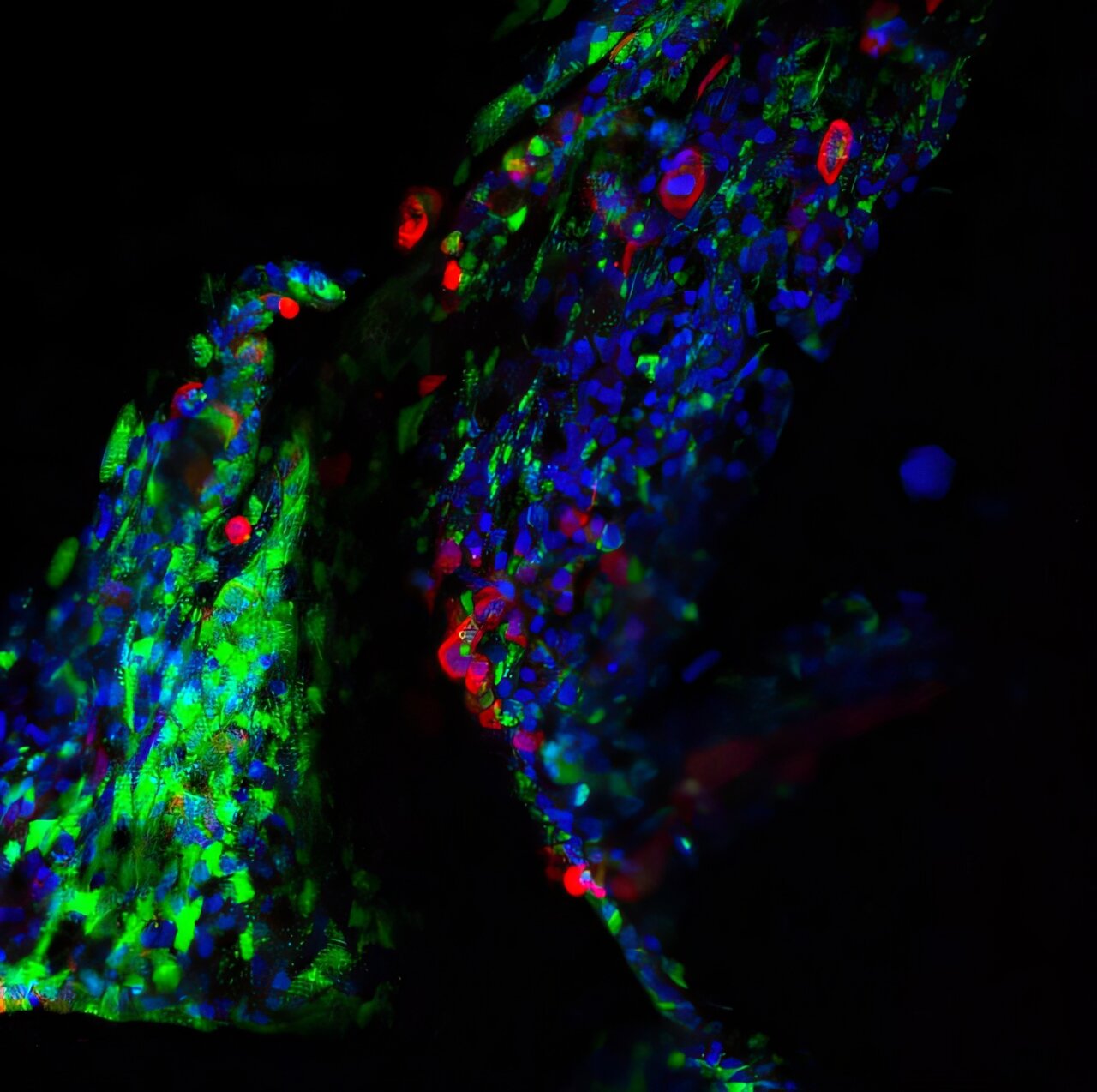 Key human proteins that power coronavirus replication point to new ...