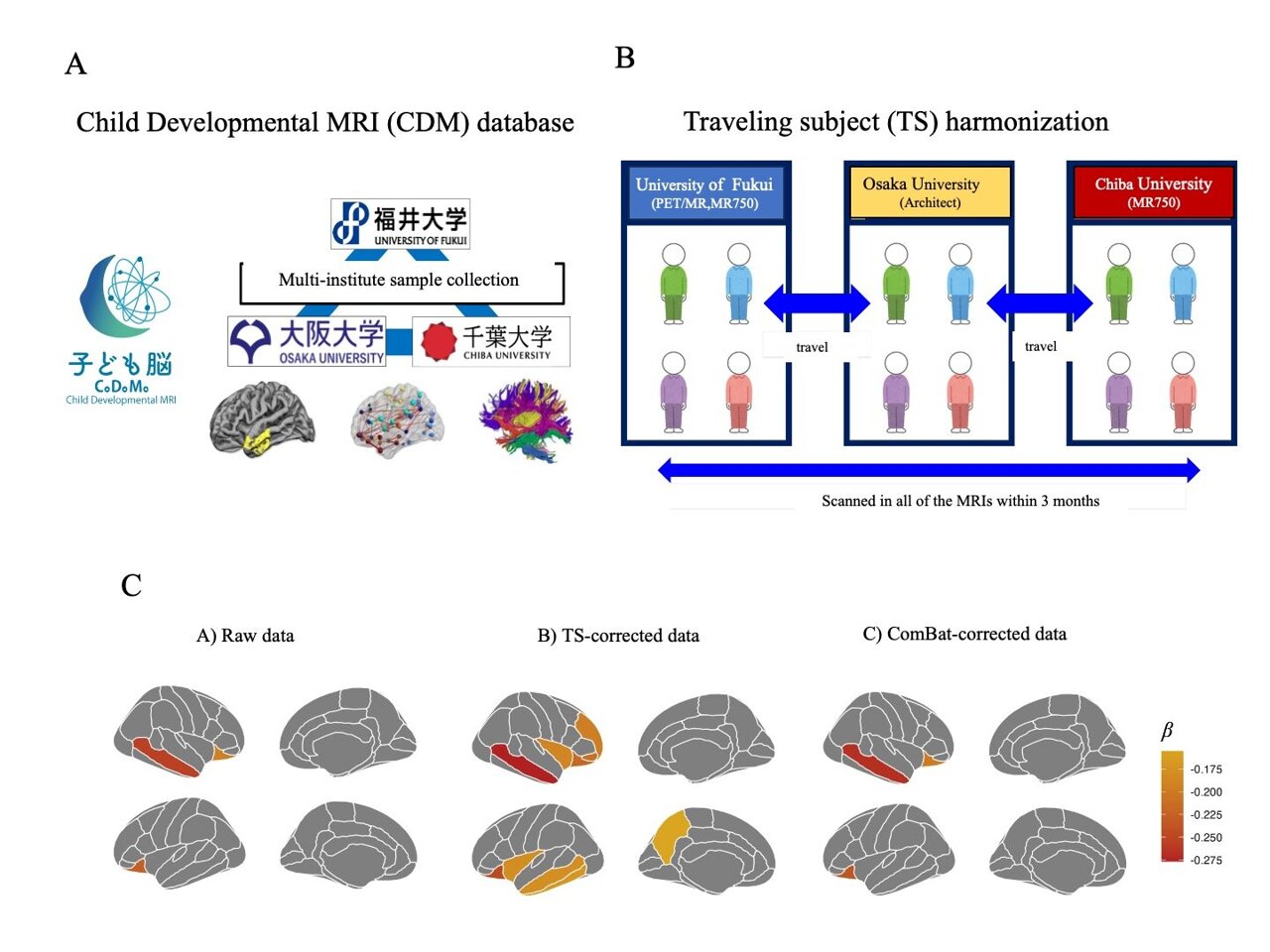 MRI correction method improves understanding of brain structure in ...