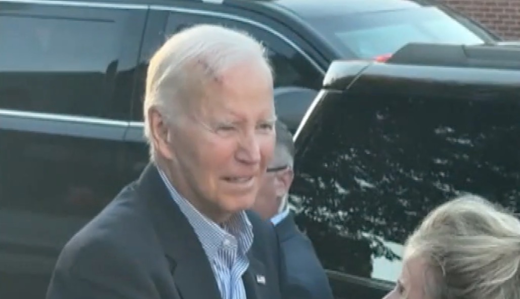 Joe Biden Spotted With Giant Gash on His Head After Skin Cancer Surgery