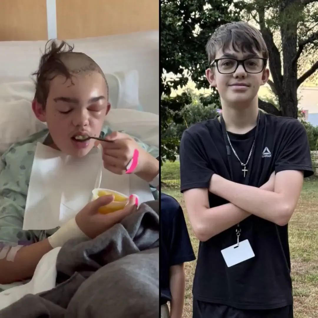 Jovem tem crânio reconstruído após ataque covarde em escola