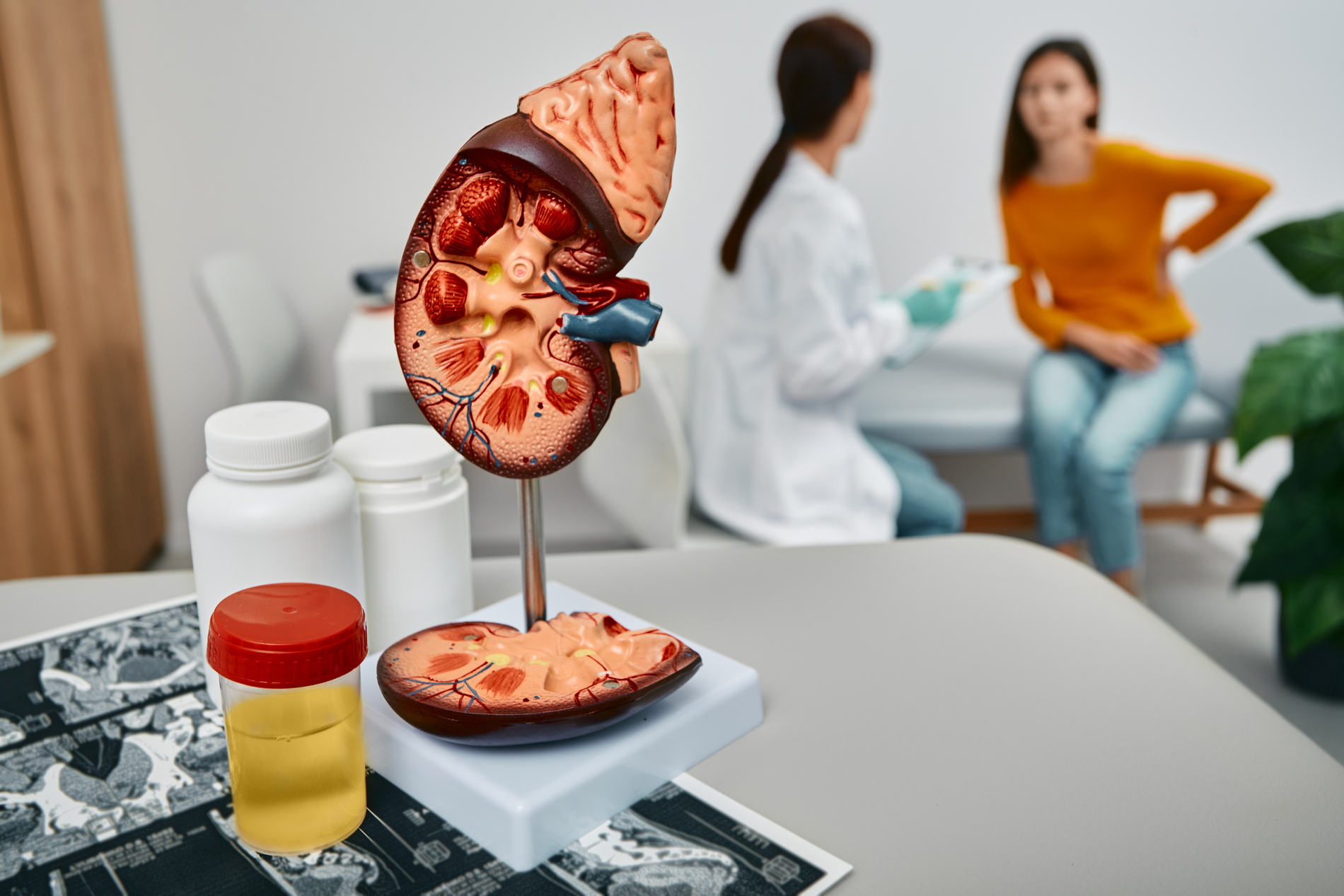 These 11 Foods Help Patients with Kidney Stones