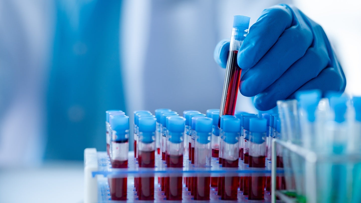 Guardant Health reports positive clinical readout update for Shield ...