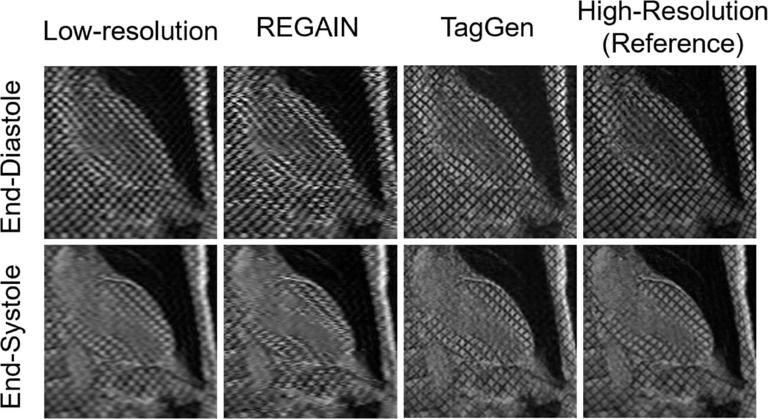 Faster, clearer, smarter: How AI is transforming cardiac imaging
