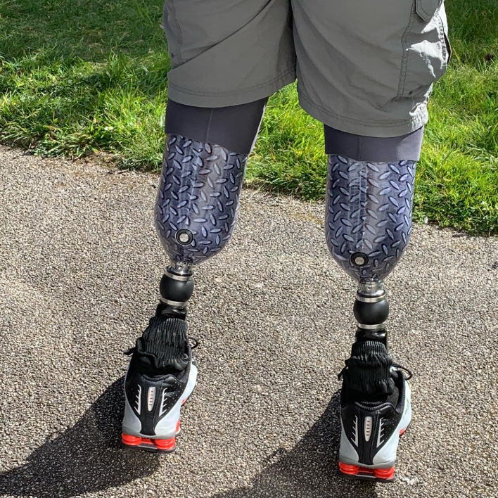 How I fell for jailed amputee surgeon's sepsis lie