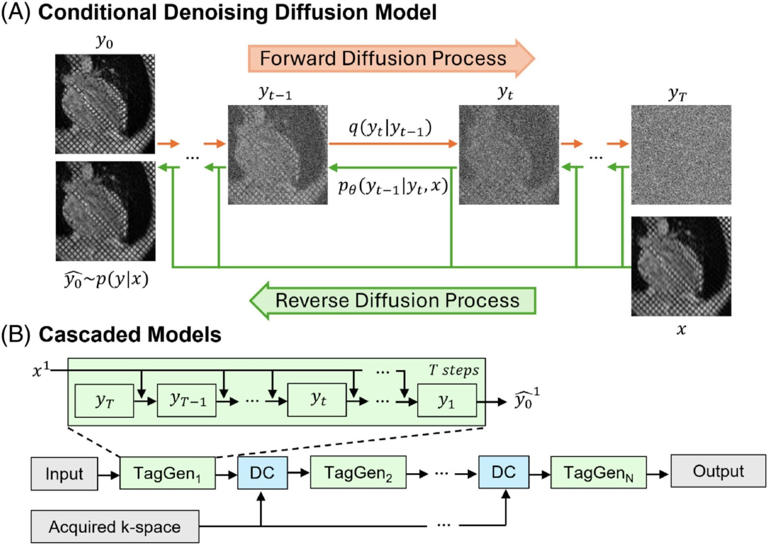 Faster, clearer, smarter: How AI is transforming cardiac imaging