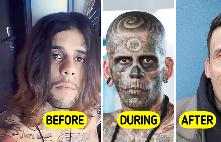 Man Who Was 95% Tattooed Shows Shocking Transformation After Laser ...