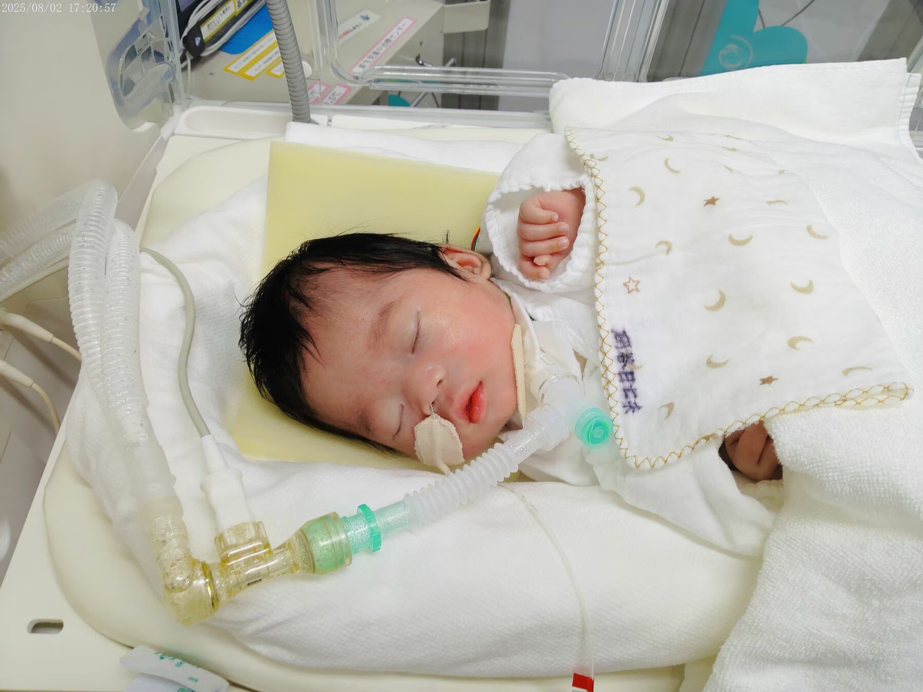 Vụ án mẹ tử nạn, con sinh non di chứng nặng vẫn không là bị hại