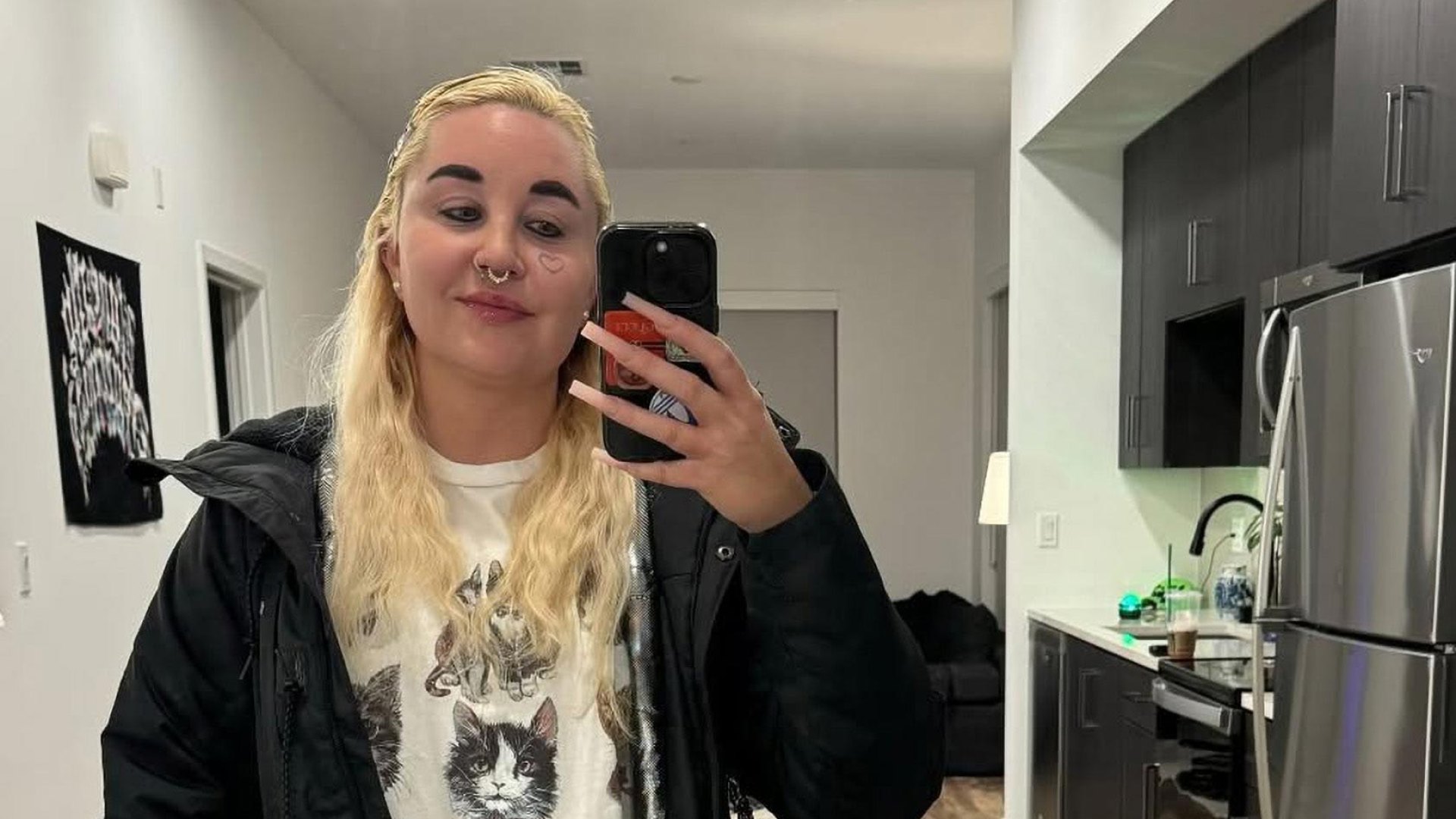 Amanda Bynes Steps Out With Bold Two-Toned Hair After Getting Lip Filler