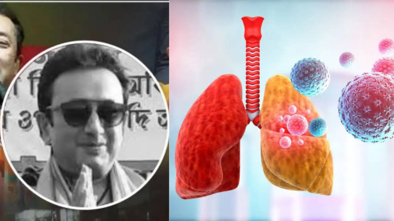 Joy Banerjee Dies of Pneumonia at 62; How Seniors Can Prevent the ...