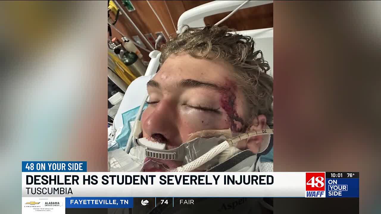 Parents, friends want answers after student severely injured at Deshler ...