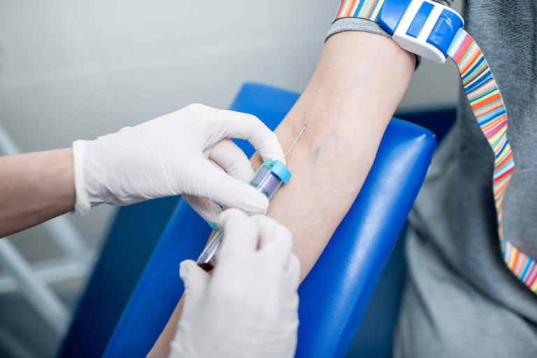 Why an RDW Blood Test Is Done and Interpreting the Results