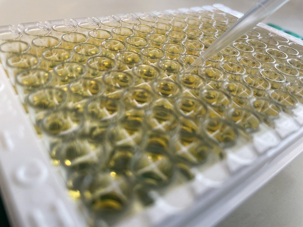Research uncovers why IBD causes blood clots—and how to prevent them