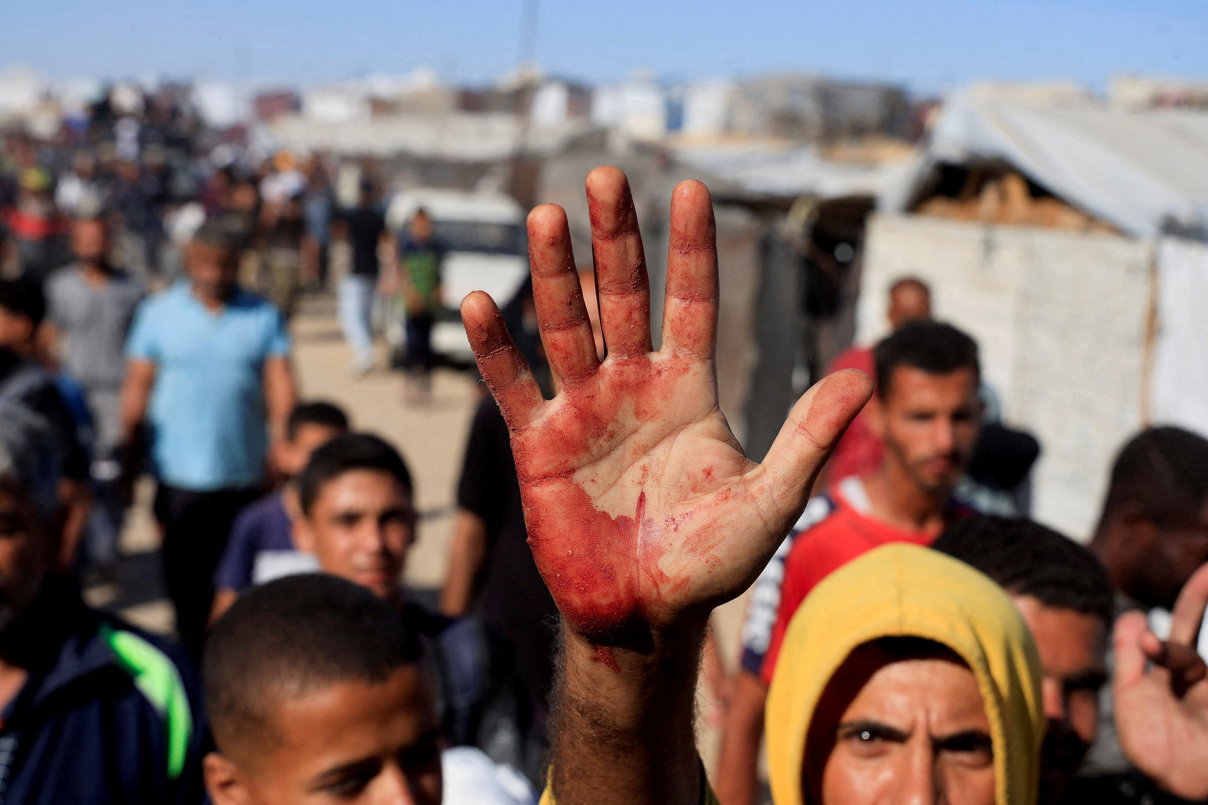 Starvation and lack of blood bags in Gaza forcing doctors to turn away ...