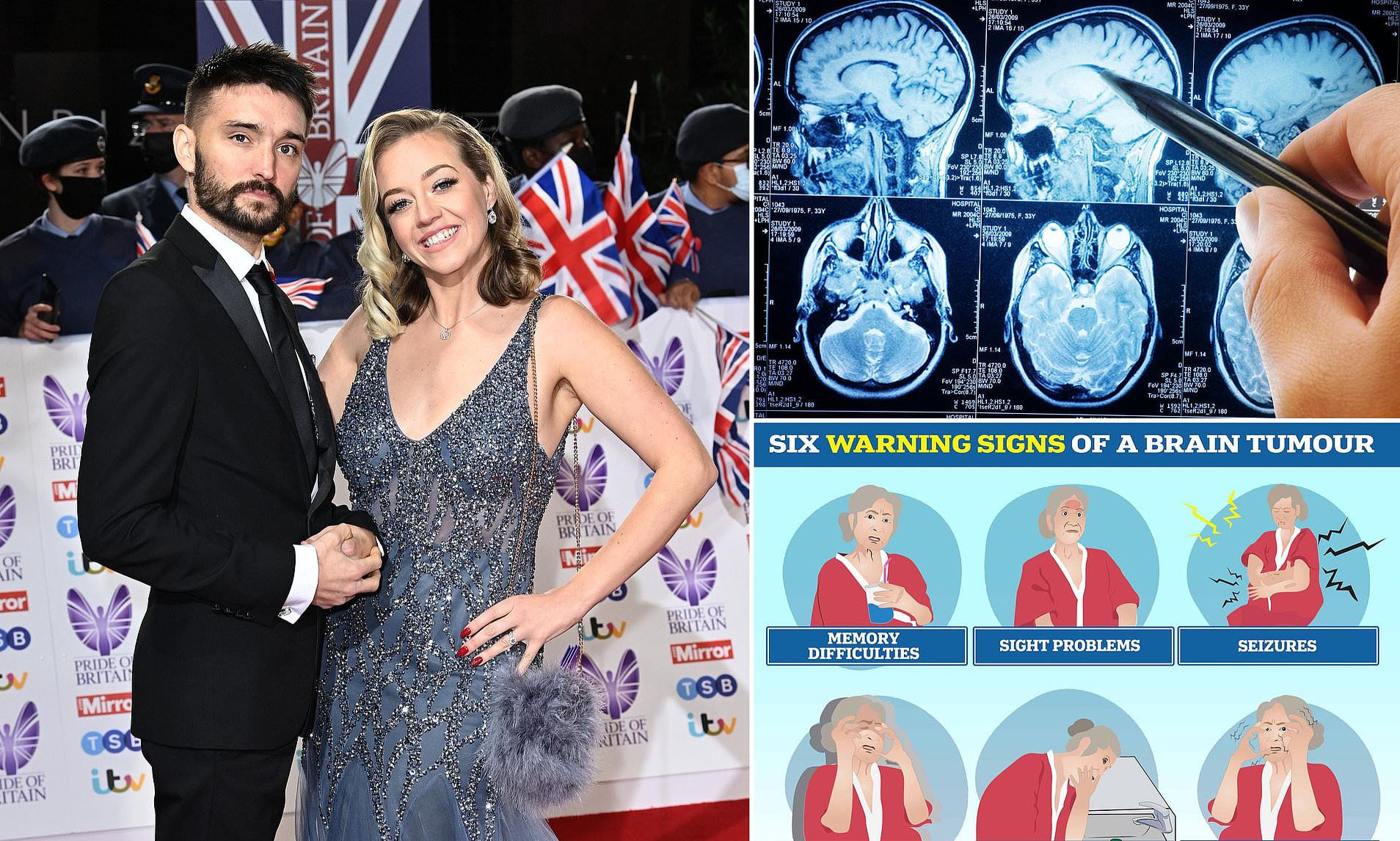 Trigger behind aggressive brain cancer uncovered - hope for prevention