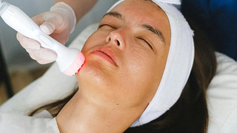 Hollywood’s latest glow secret: salmon DNA microneedling takes skin to ...