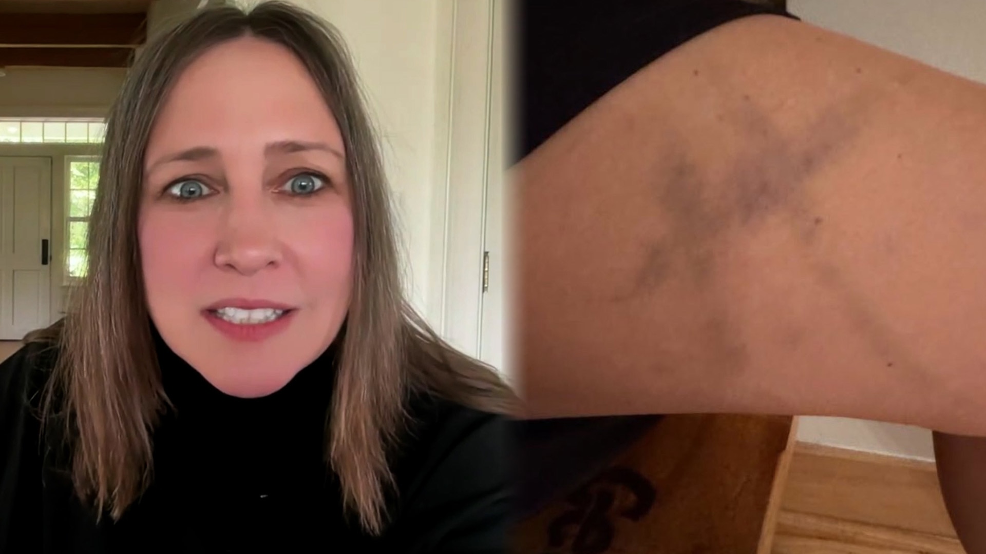 Vera Farmiga Details Cross-Shaped Bruises Appearing on Her Body During ...
