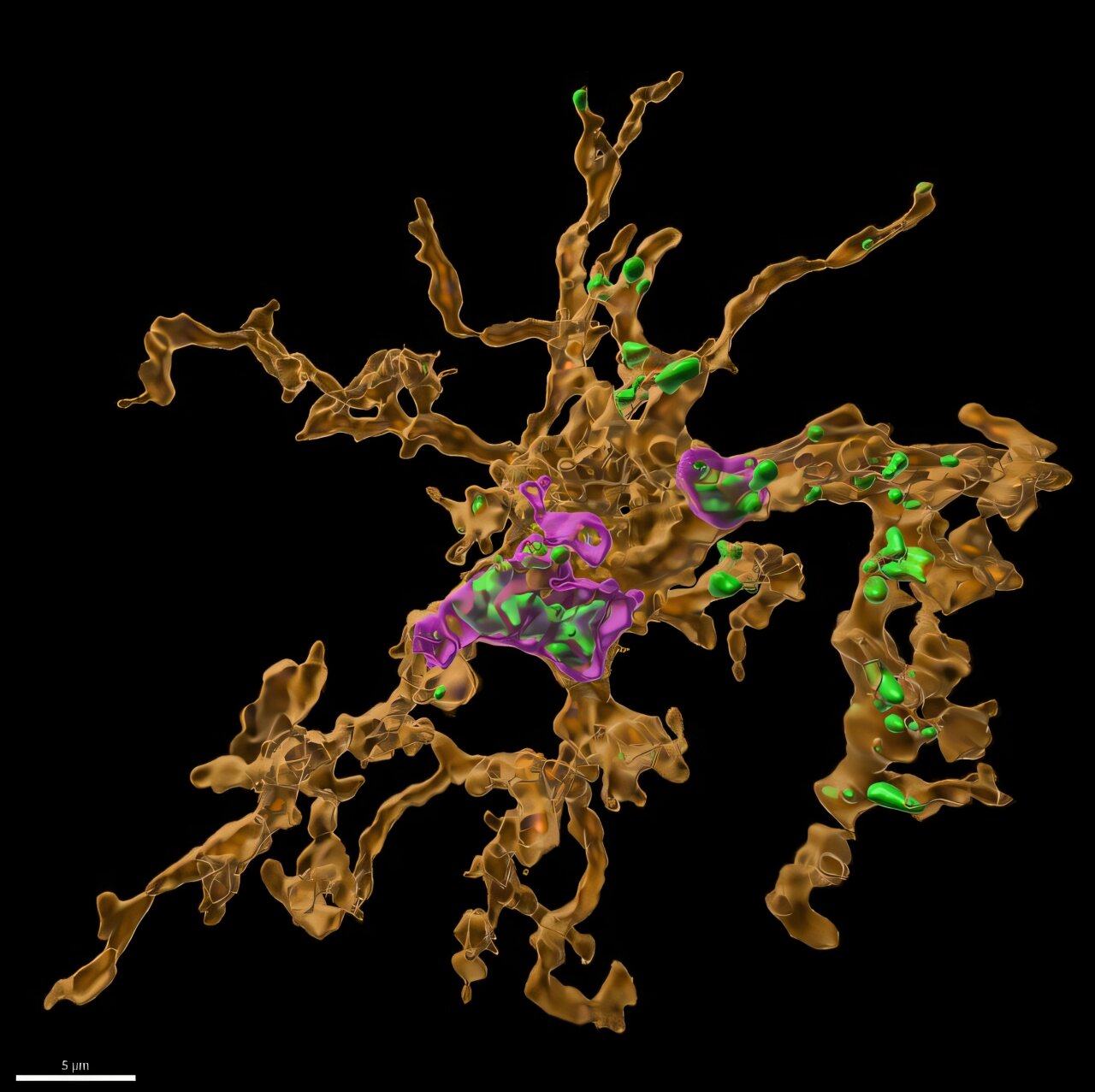 How the brain's immune system drives drug relapse and a potential new way to stop it