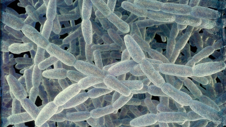 Legionnaires' disease concerns at East Village housing complex prompts ...