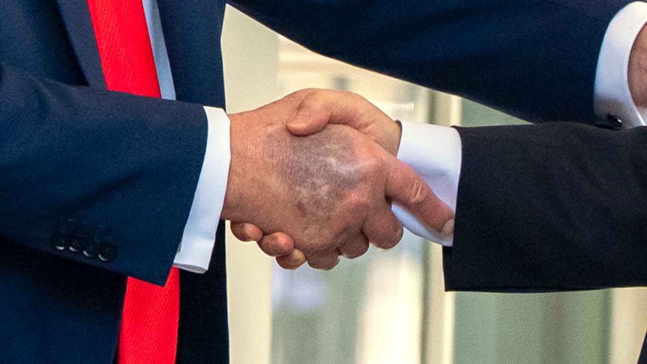 Trump’s Hand Makeup And Bruising Go Viral — Here's The Official Explanation
