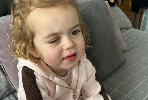 Toddler’s ‘sore eye’ removed after rare cancer diagnosis