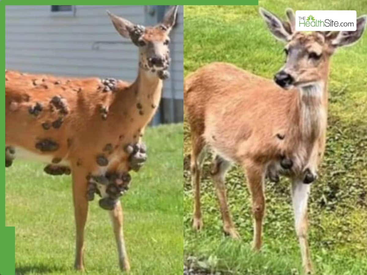 Mutant Deer With Flesh-Bubbles Spotted In US: Scientists Warn Of Deadly ...