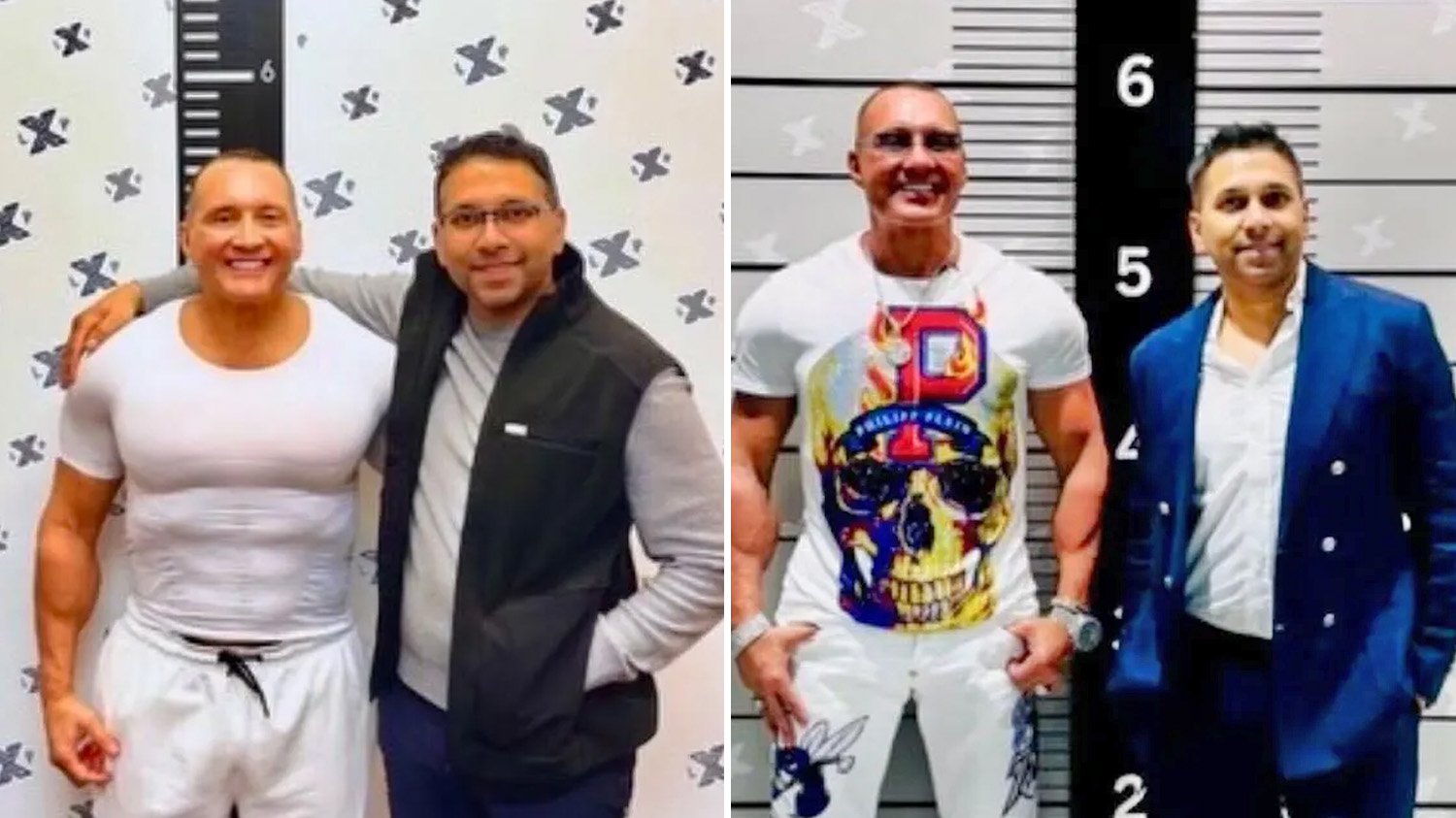 Man undergoes £62k height surgery to reach 6'3 goal