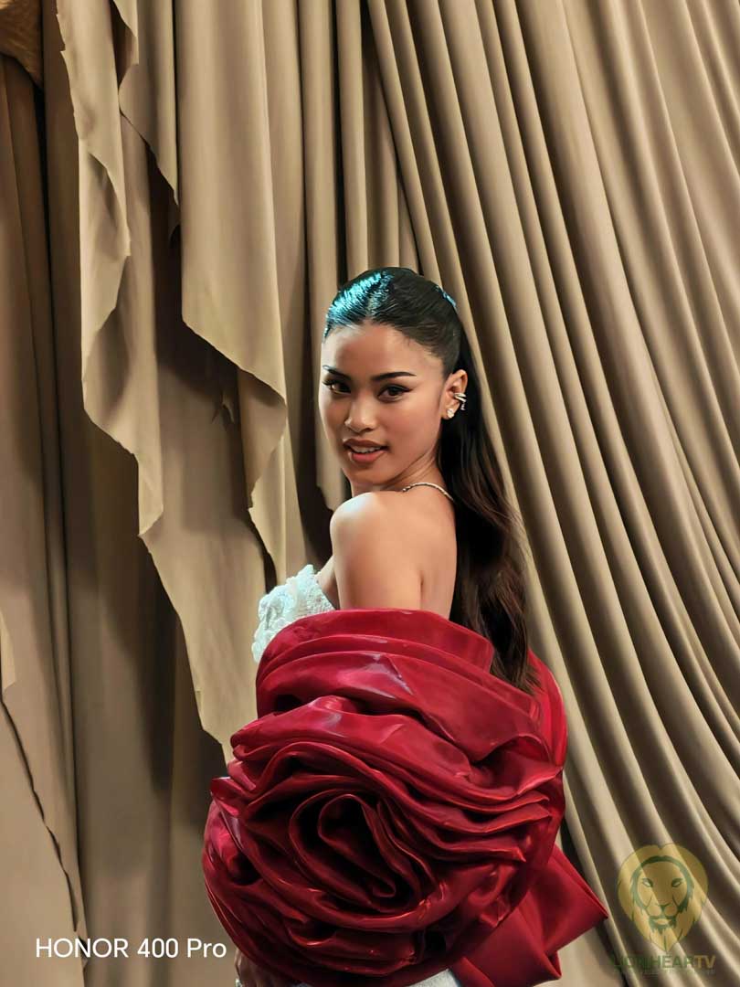 Shuvee Etrata recalls being bullied for her skin color and features