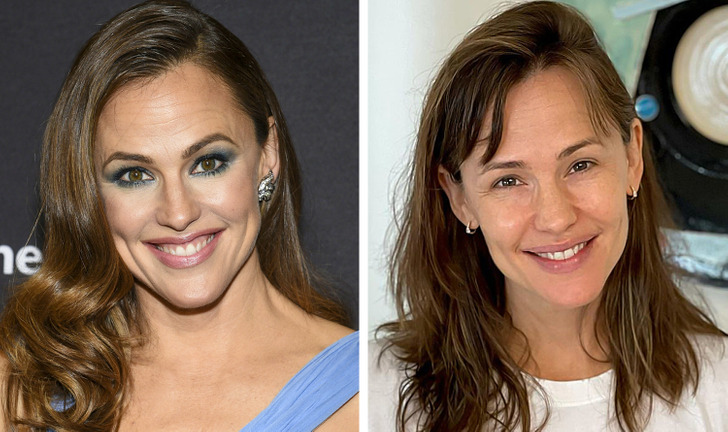 16 Stars Who Prove Real Beauty Needs No Filter