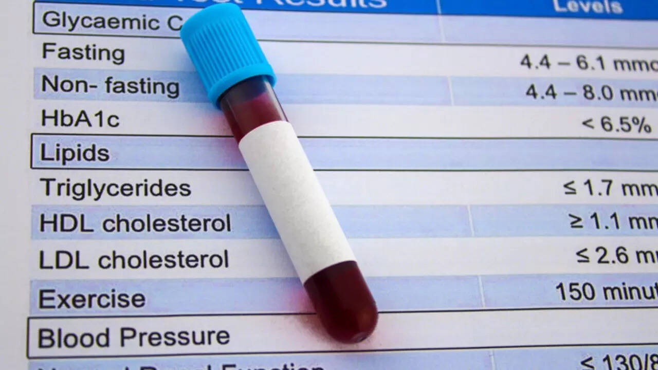 Heart health: 10 cardiologist-recommended medical tests to detect heart ...