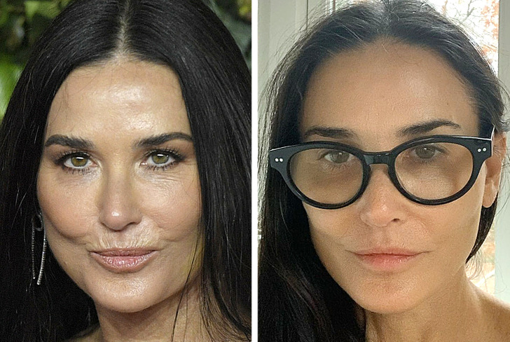 16 Stars Who Prove Real Beauty Needs No Filter