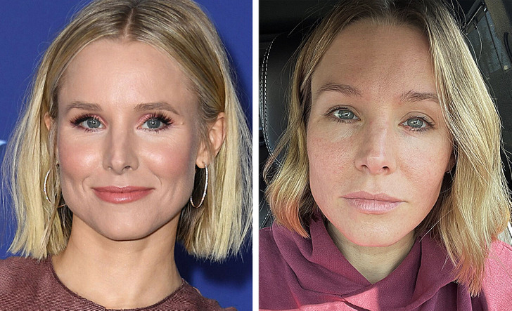16 Stars Who Prove Real Beauty Needs No Filter