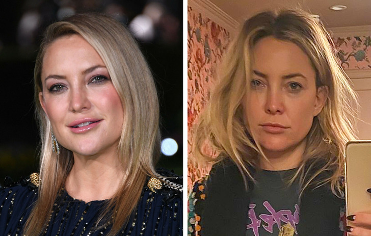 16 Stars Who Prove Real Beauty Needs No Filter